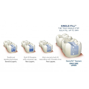 SonicFill™ 3 Composite A2 - Niche Dental Solution