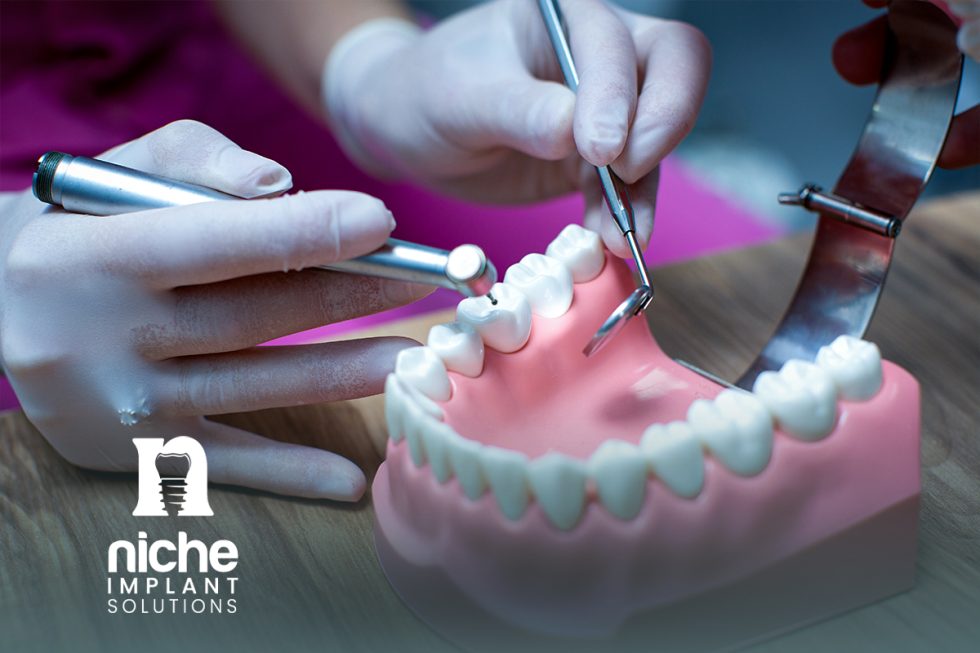 gum healing after implant | learn your Best solution now