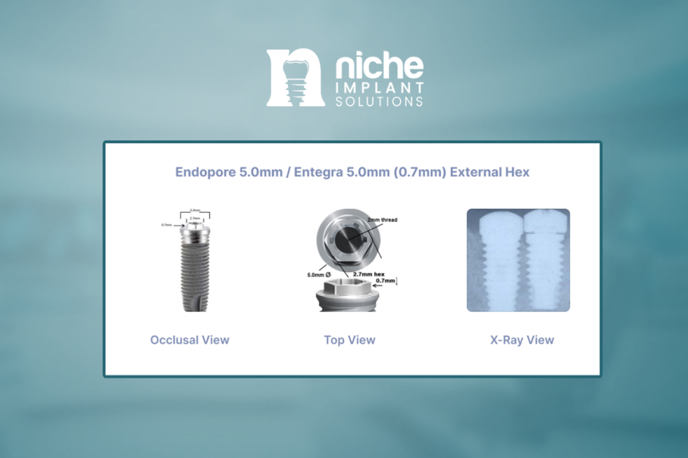 innova implant | You can get it from Niche now | Best prices